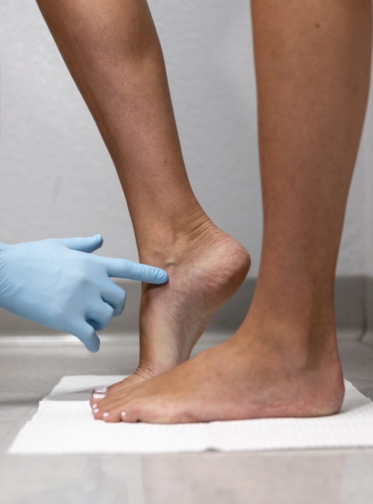 Ankle Surgery – Belmont Anderson DPM Las Vegas Podiatrist