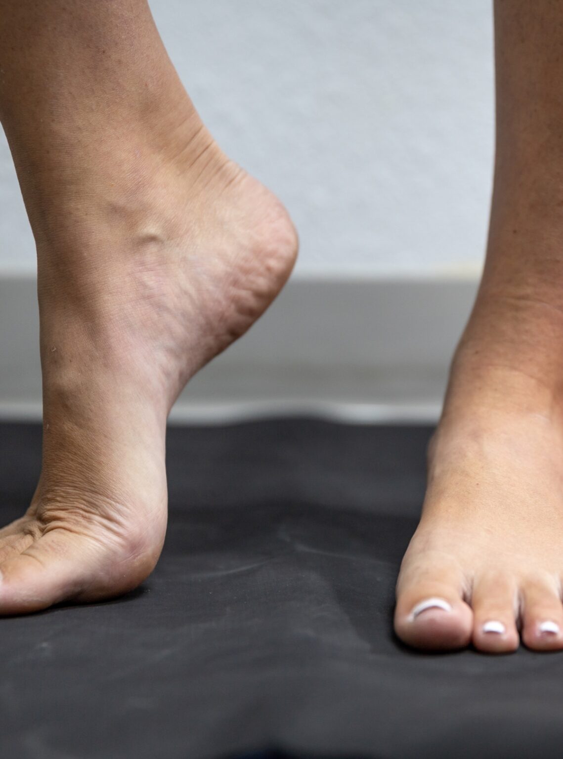 Arch Pain – Belmont Anderson DPM Las Vegas Podiatrist
