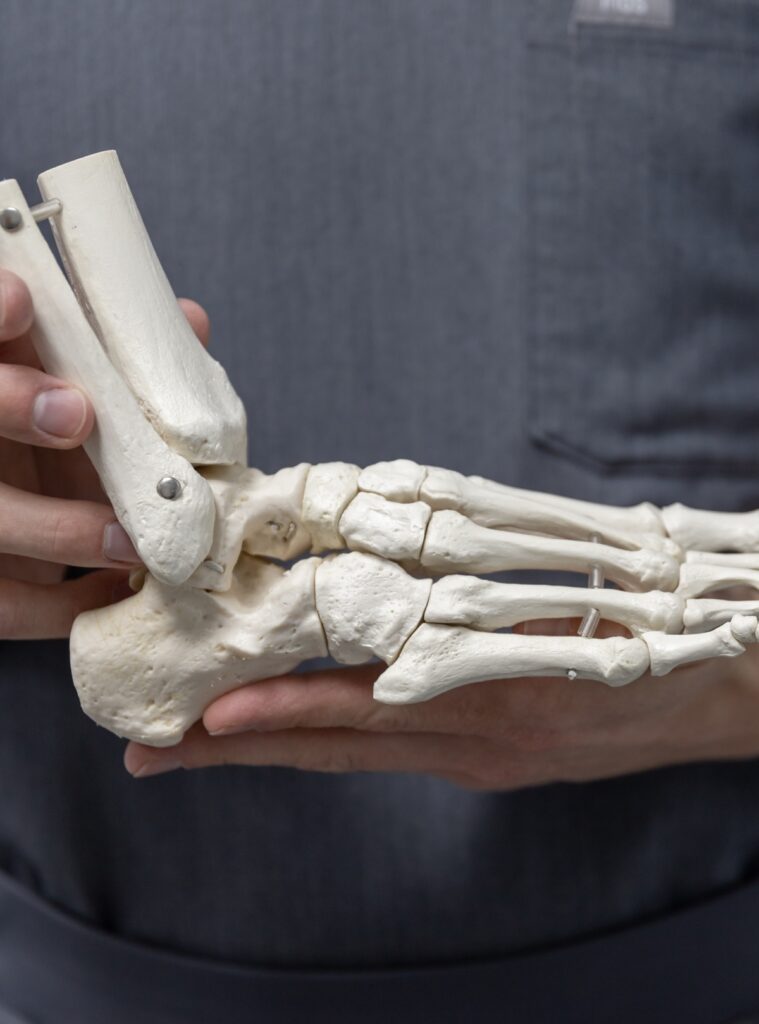 Drop Foot – Belmont Anderson DPM Las Vegas Podiatrist