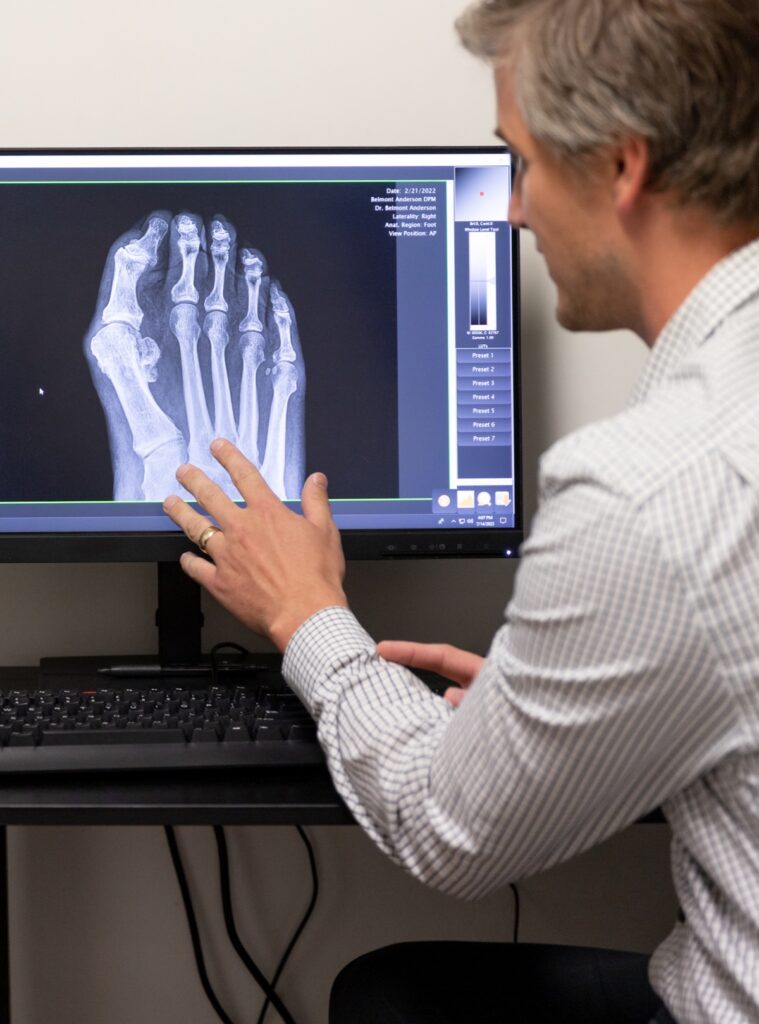 X-rays for Foot & Ankle – Belmont Anderson DPM Las Vegas Podiatrist